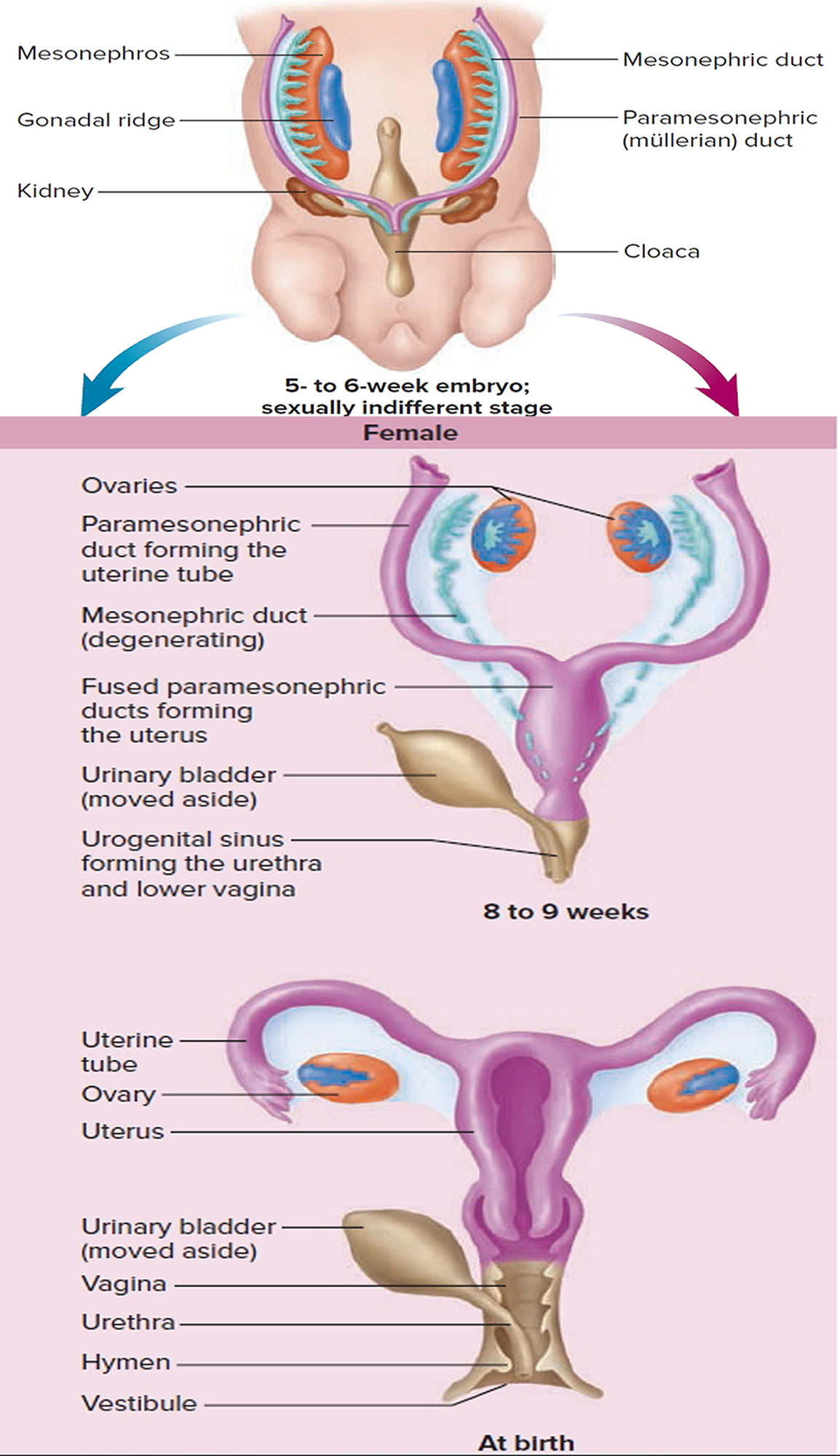 Bicornuate Uterus Causes Symptoms Ultrasound Fertility Pregnancy