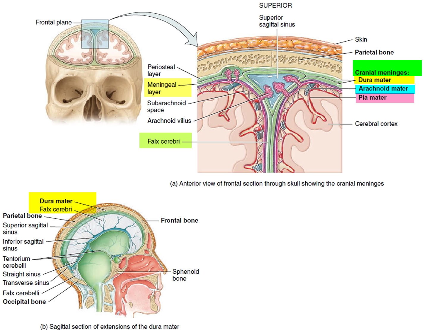 Meningioma Brain Tumor Causes Symptoms Survival Rate Treatment