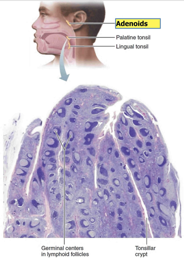 Adenoids Function Location Enlarged Adenoids Causes Symptoms And Treatment