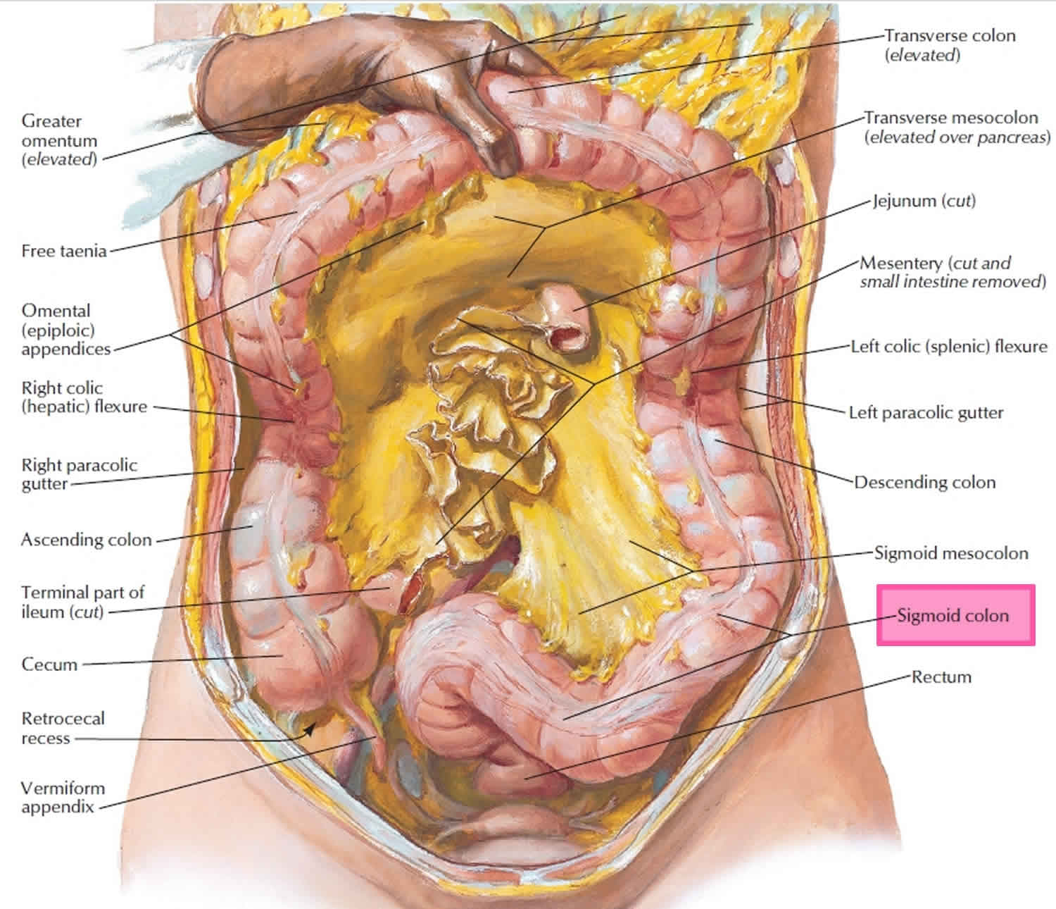 Sigmoid Colon Anatomy Location Function Polyps Diverticulosis Cancer