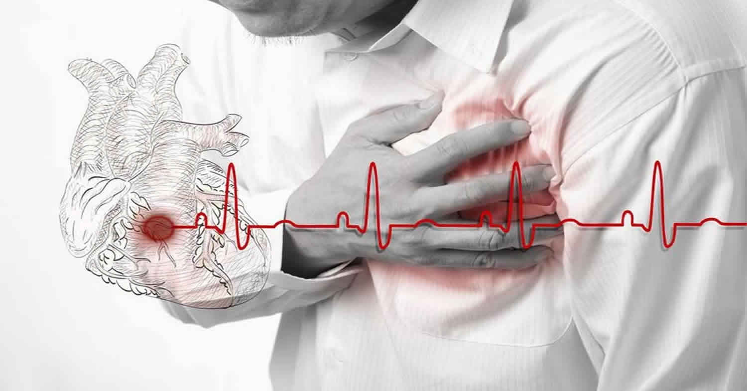 Angina Pectoris Or Stable Angina Causes Symptoms Diagnosis Treatment