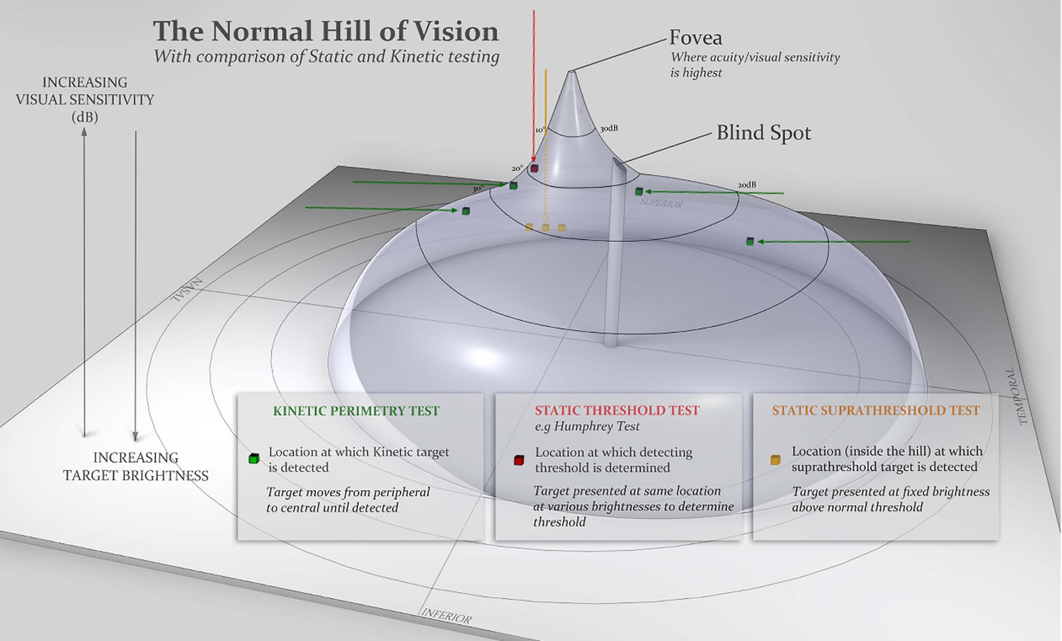 Visual Field Test Visual Field Test Results Interpretation