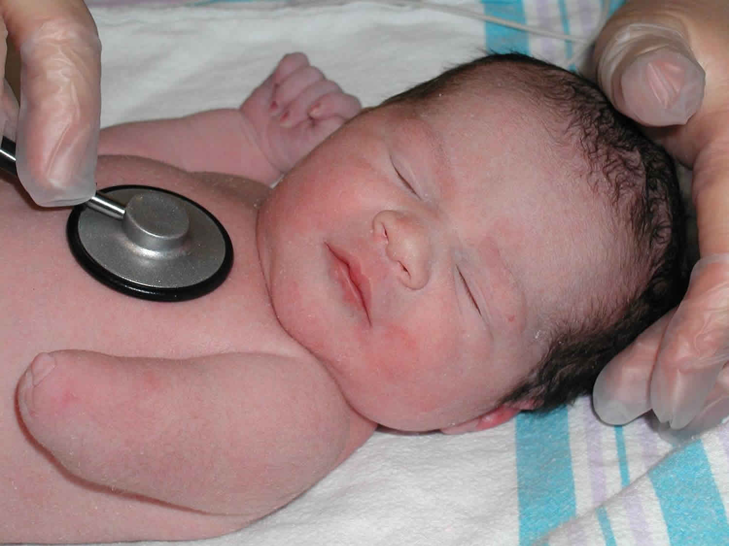Amniotic Band Syndrome Causes Symptoms Diagnosis Treatment Amniotic Band Syndrome Causes Symptoms Diagnosis Treatment