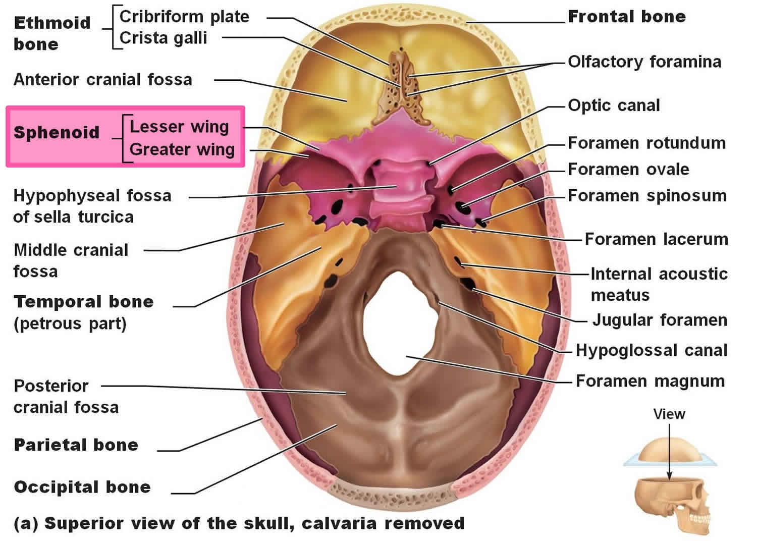 Sphenoid Bone Anatomy Function Parts Sphenoid Bone Fracture